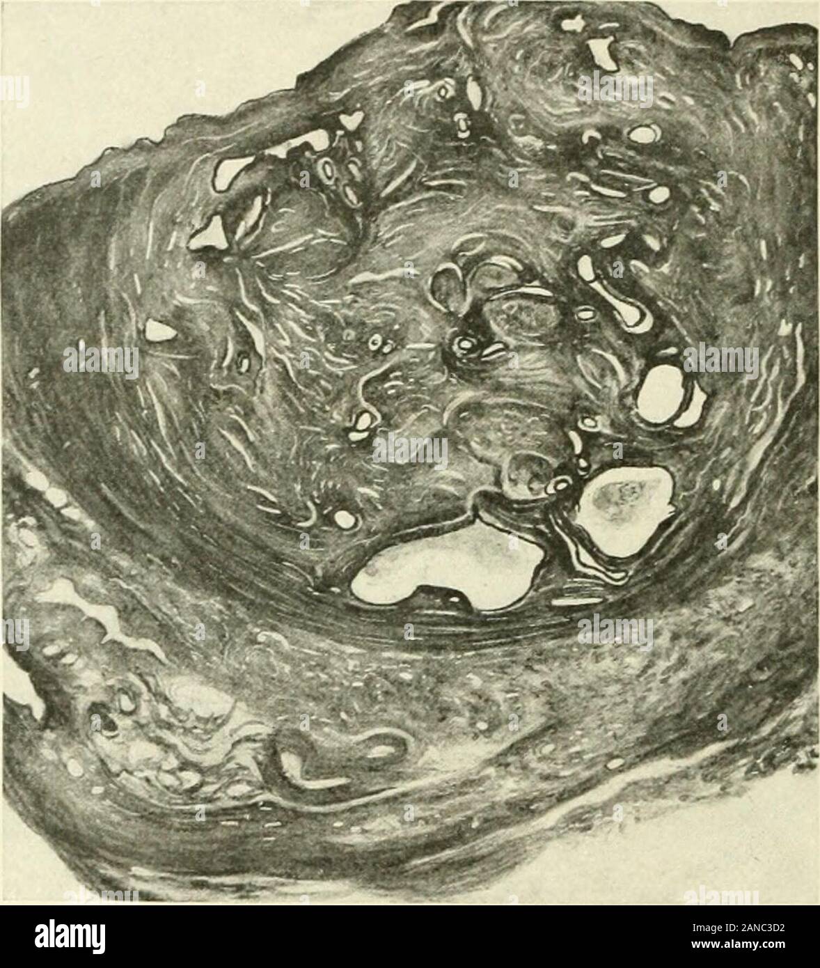 Wasa model hi-res stock photography and images - Alamy