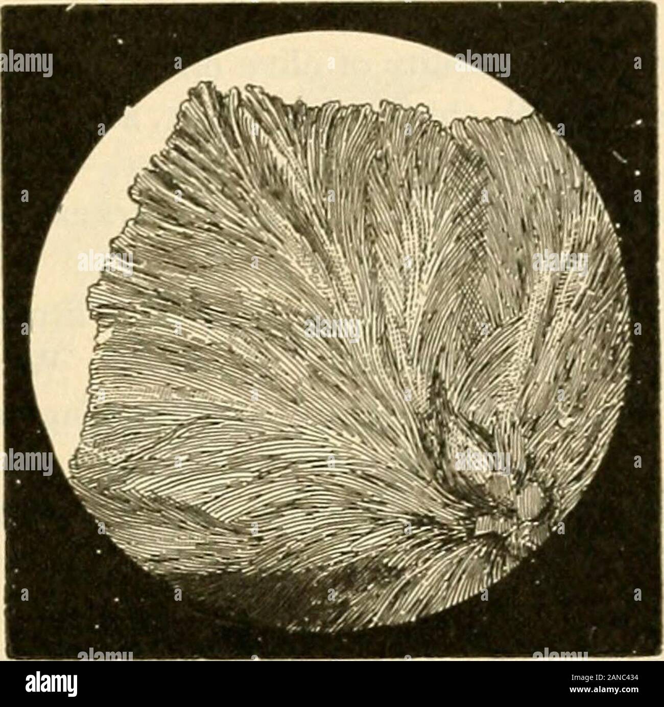 Adipocere hi-res stock photography and images - Alamy