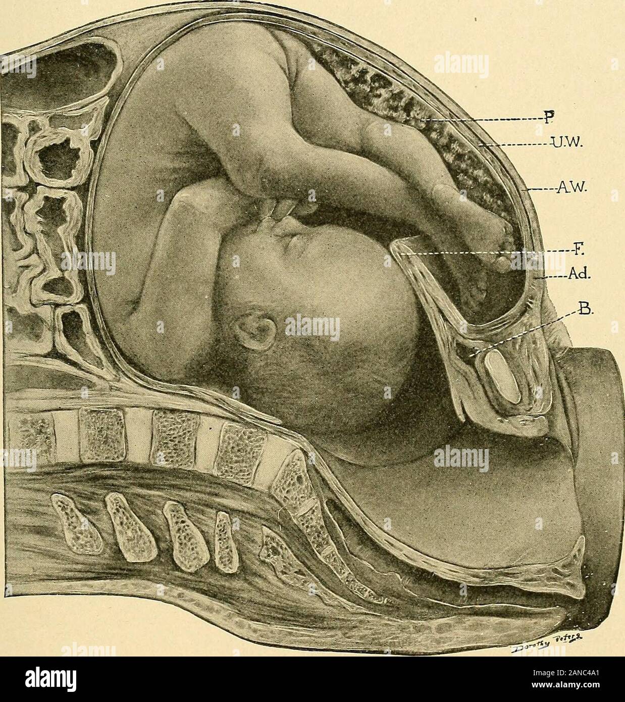 Cesarean section . m operation as to render cesarean section thesafest ...