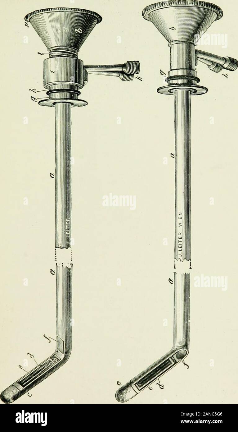 Cystoscope hi-res stock photography and images - Alamy