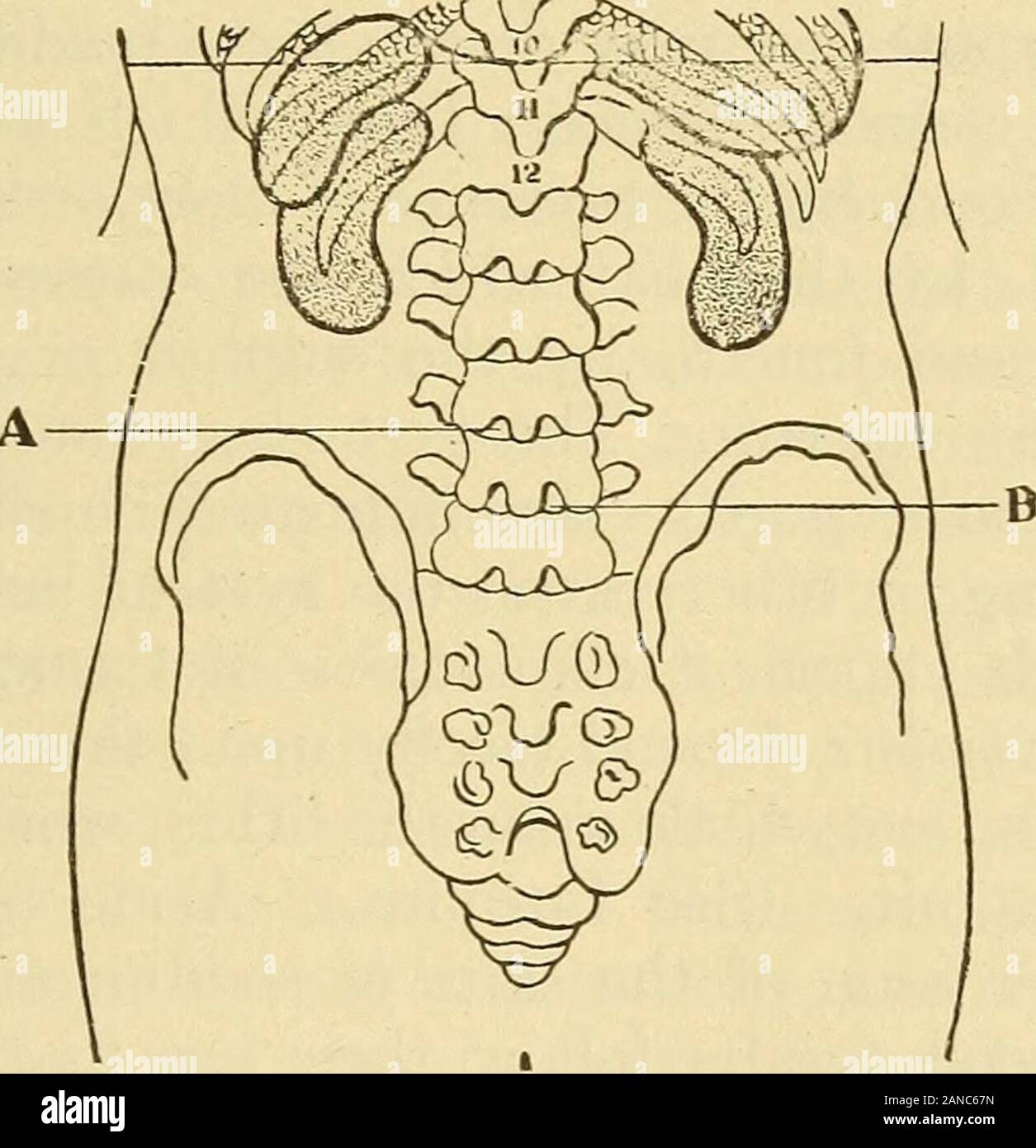 Third lumbar vertebrae hi-res stock photography and images - Alamy
