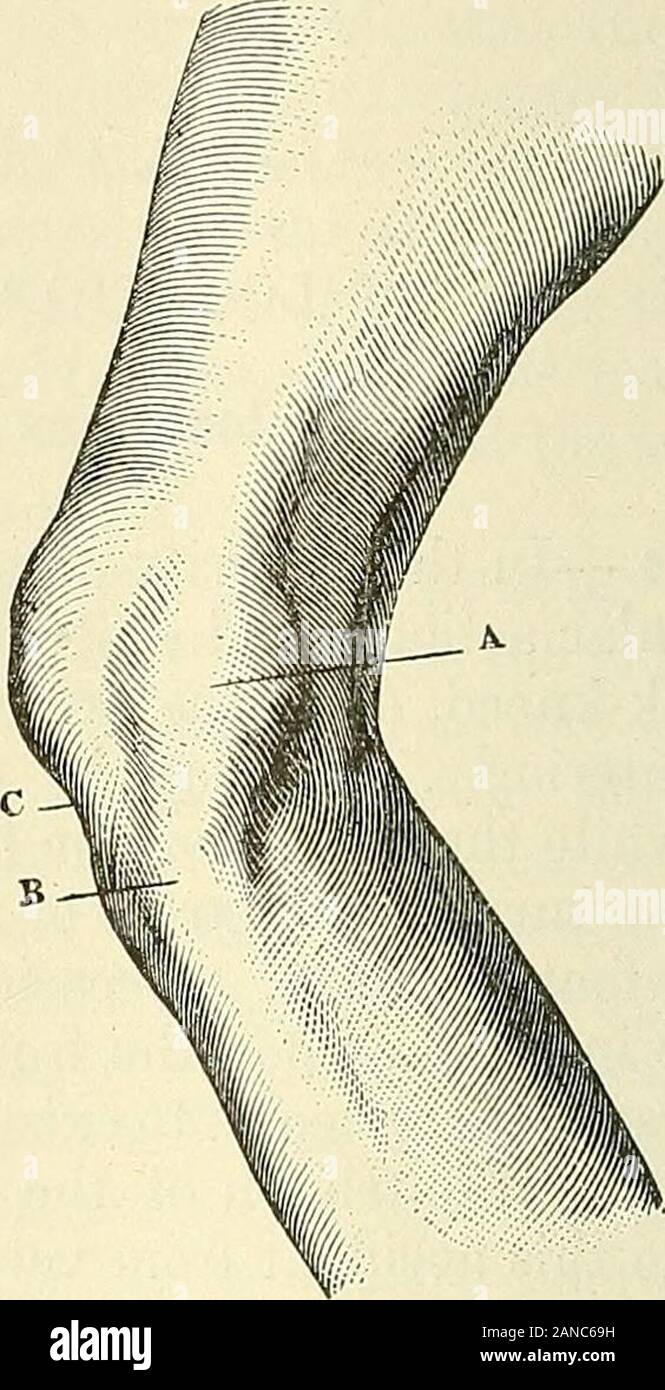 Patellae hi-res stock photography and images - Alamy