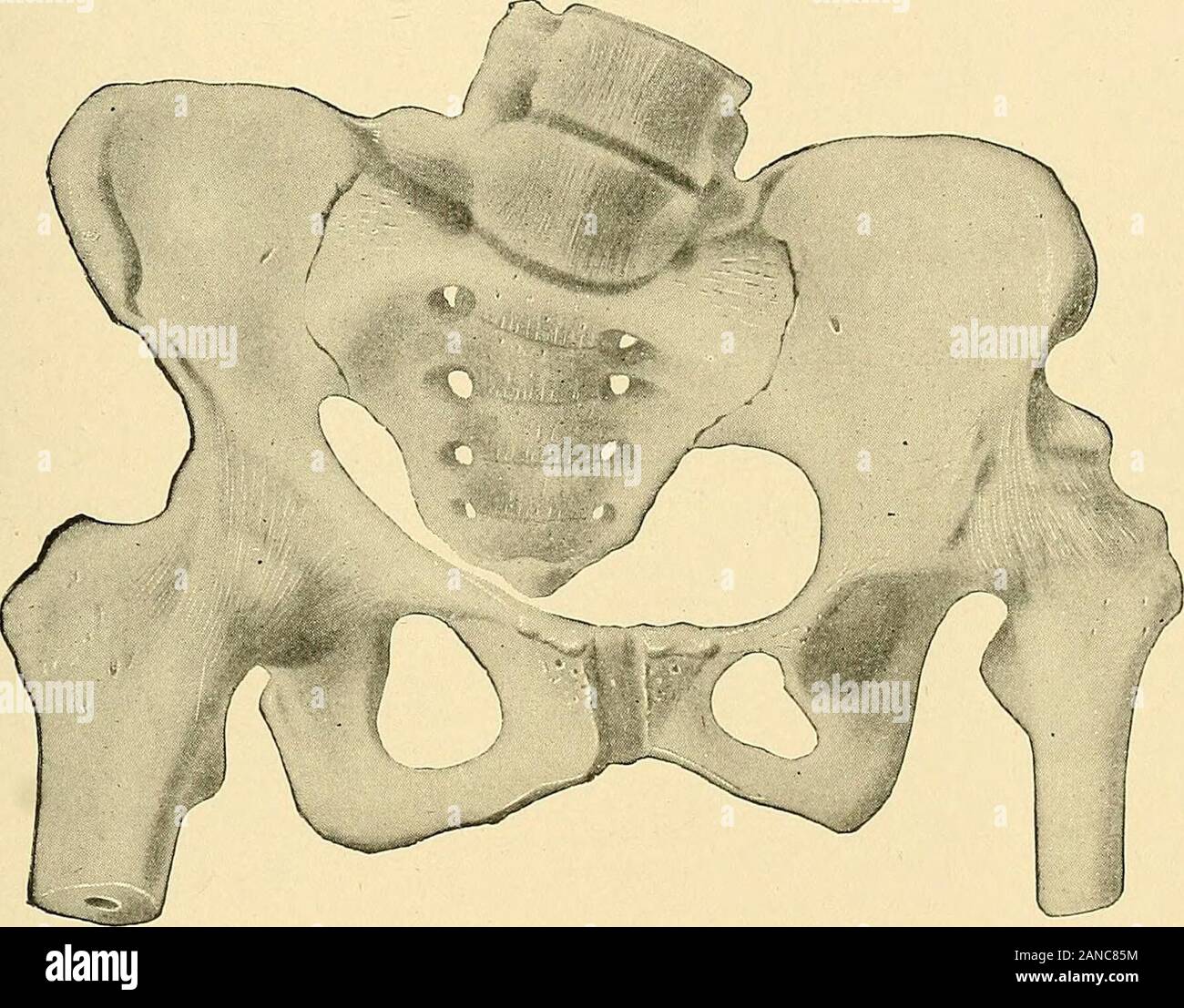 Dystocia hi-res stock photography and images - Alamy