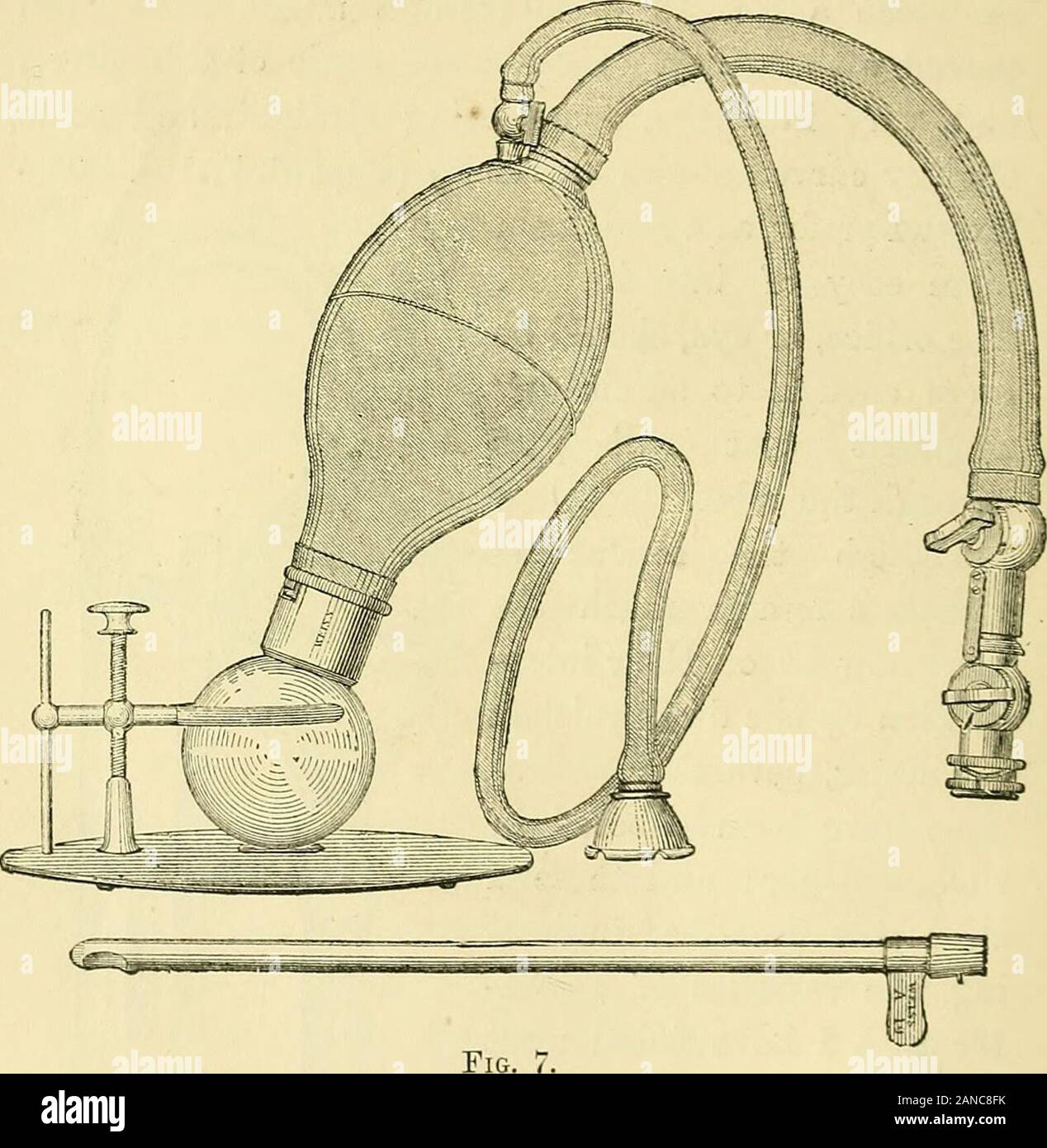 The modern treatment of stone in the bladder by litholapaxy : a ...