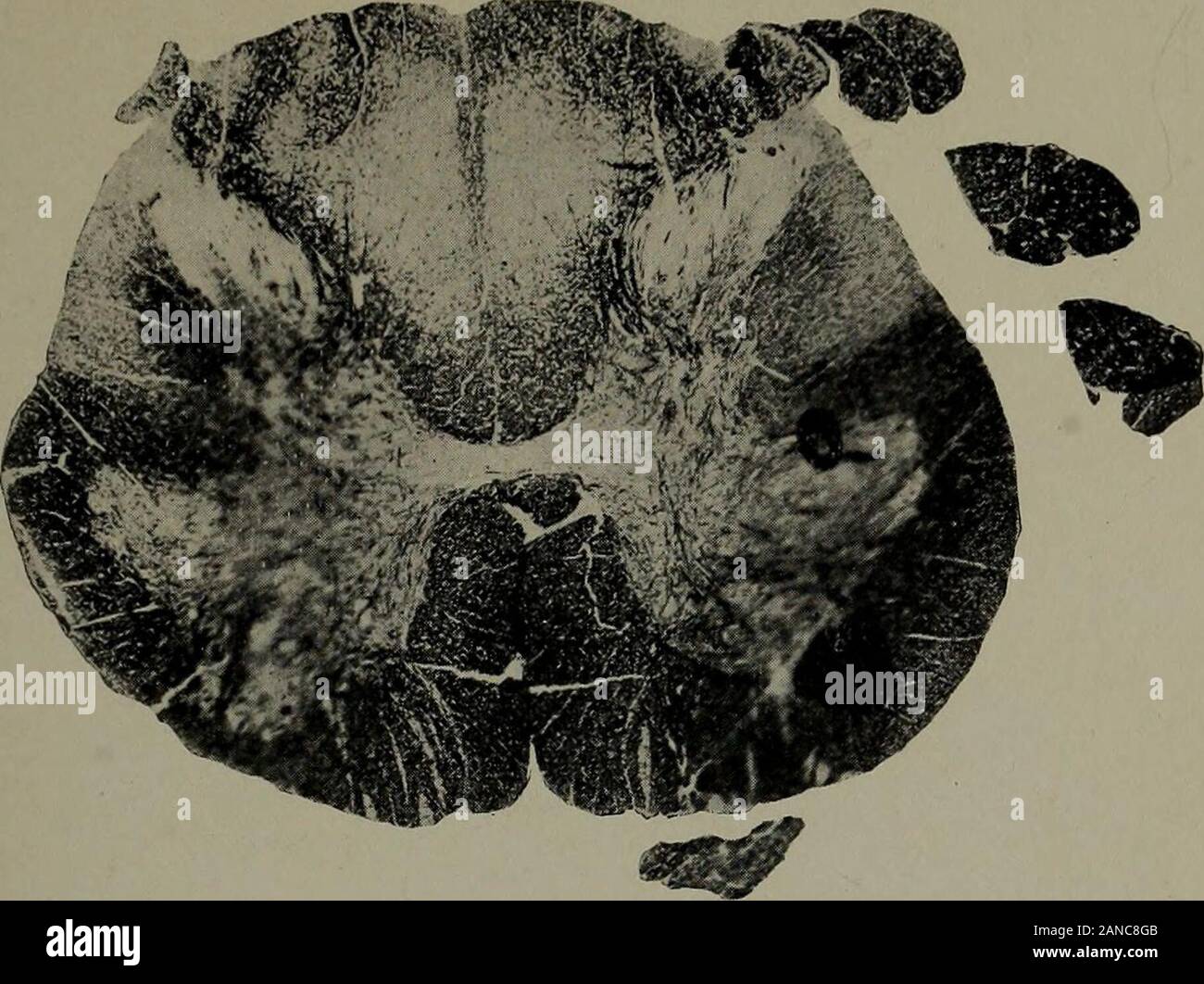 Medical communications of the Massachusetts Medical Society . Case 2 ...