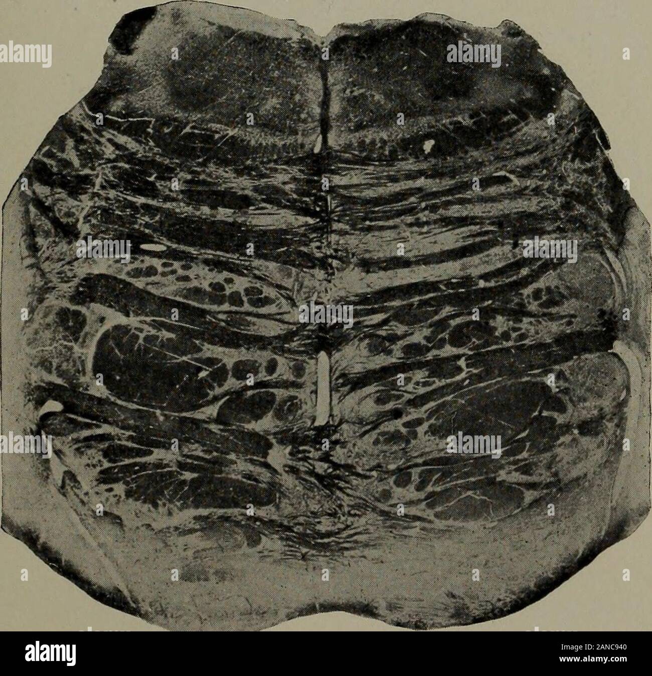 Medical communications of the Massachusetts Medical Society . Case 2 ...