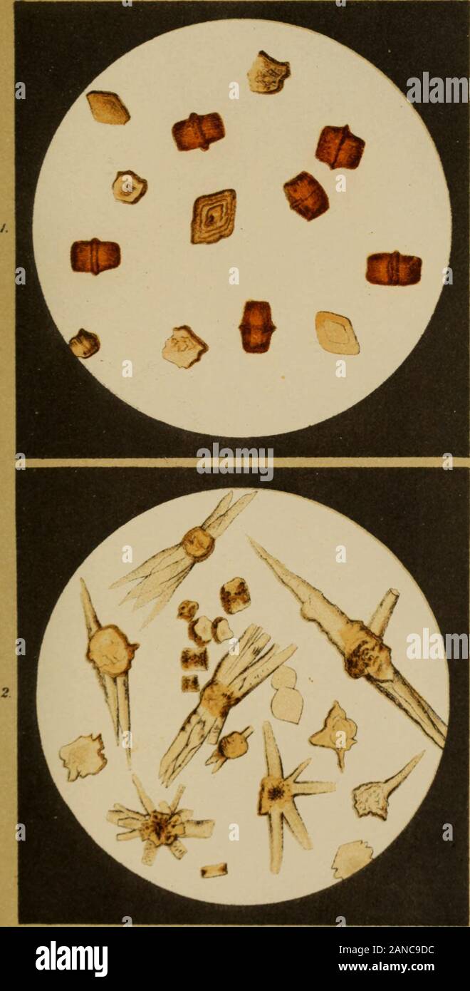 Pyelitis hi-res stock photography and images - Alamy