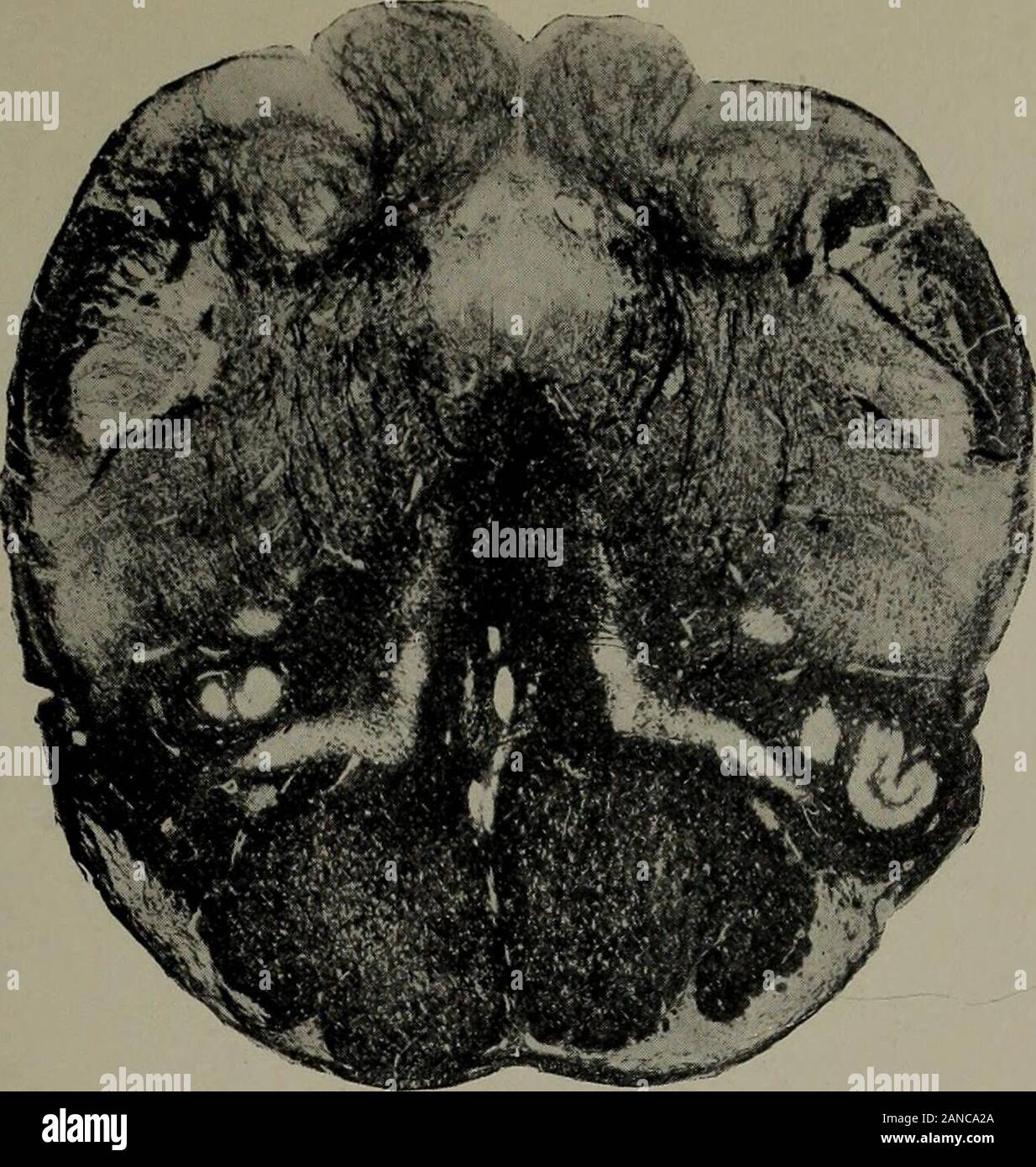 Medical communications of the Massachusetts Medical Society . Case 2 ...