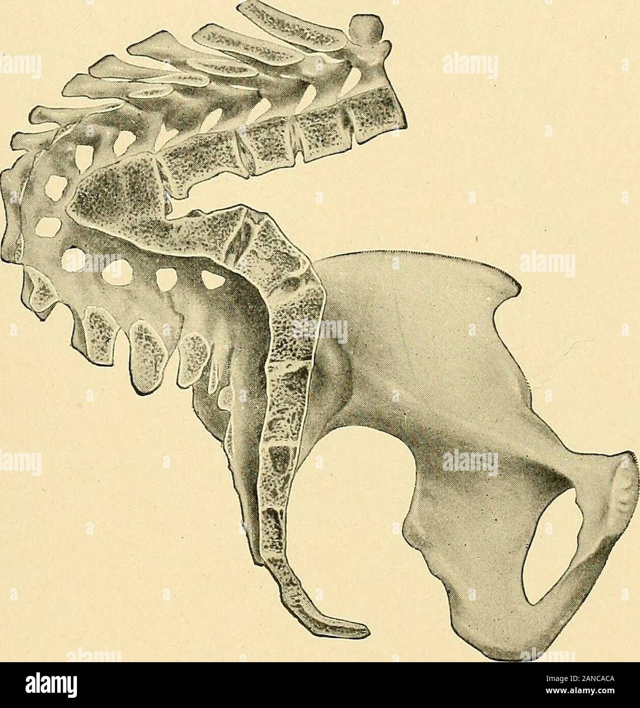 Funnelshape hi-res stock photography and images - Alamy