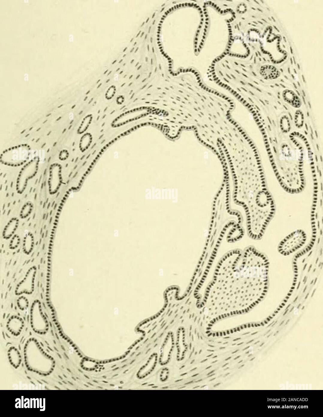 Fallopian tube wall hi-res stock photography and images - Alamy