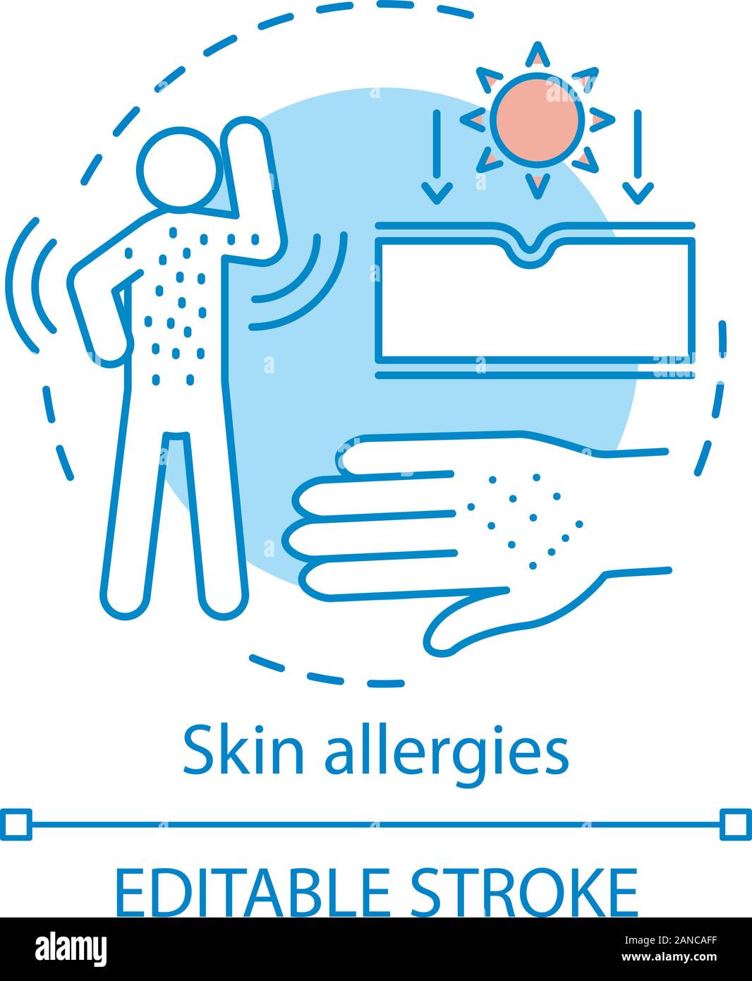 Skin allergies concept icon. Rash, contact dermatitis, hives idea thin ...