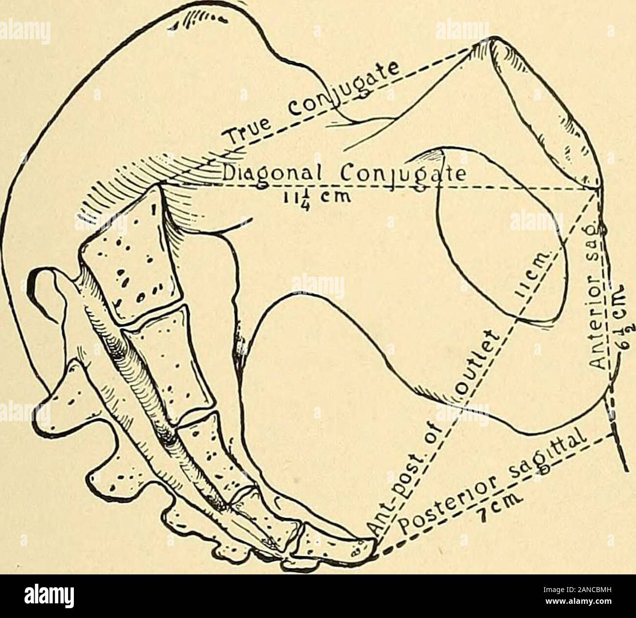 cesarean section indications