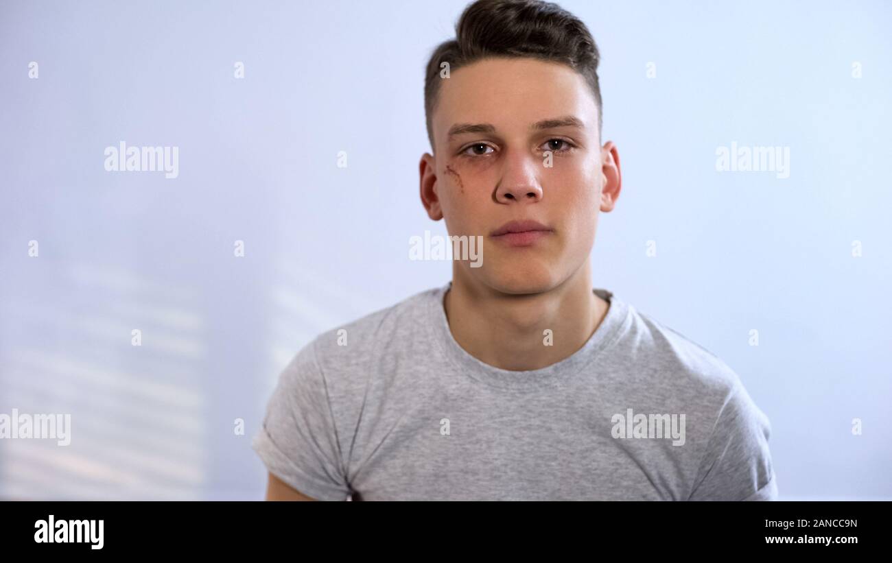 Confident male teenager with wound on cheekbone looking at camera ...