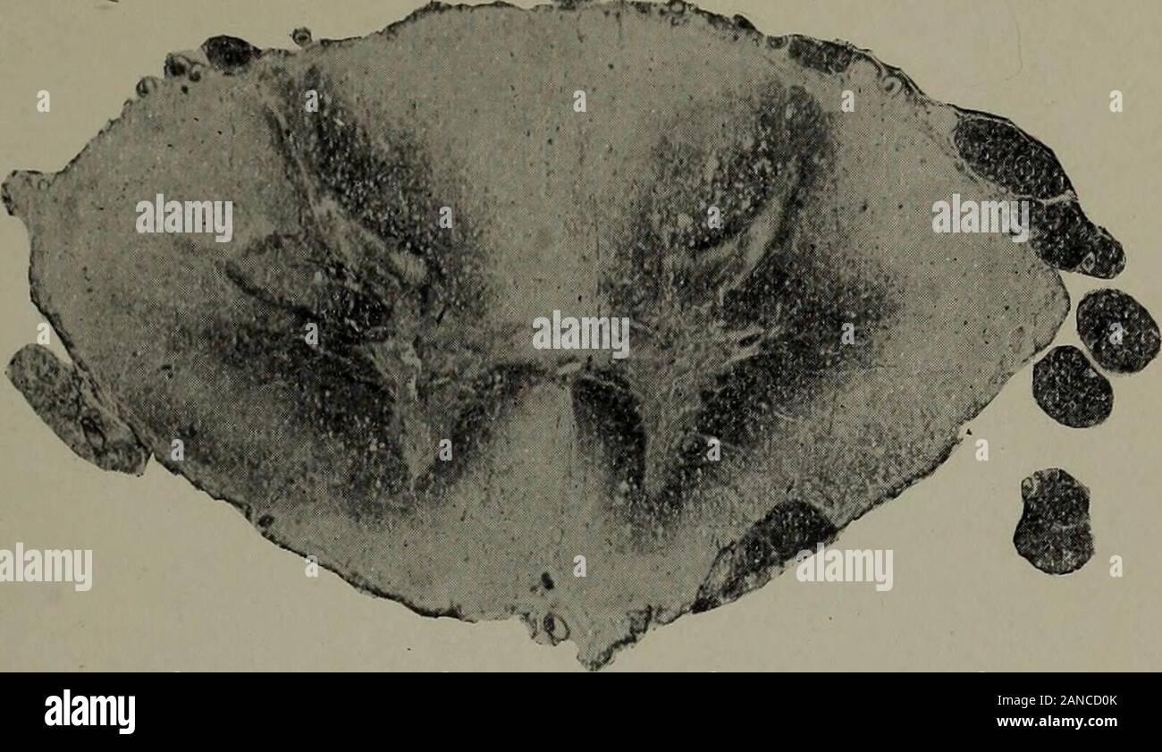 Mid thoracic hi-res stock photography and images - Alamy