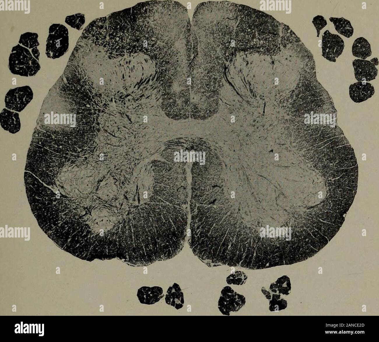 Medical communications of the Massachusetts Medical Society . Case 1 ...