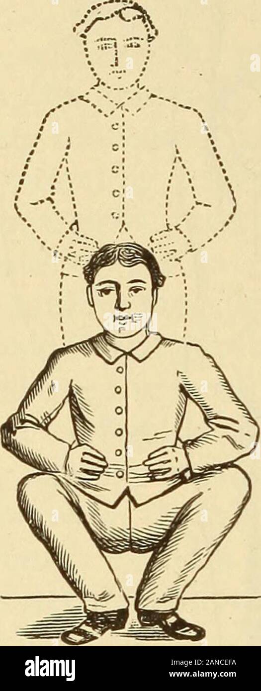 A text-book of practical therapeutics . Fig. 98.—Wing standing, side ...