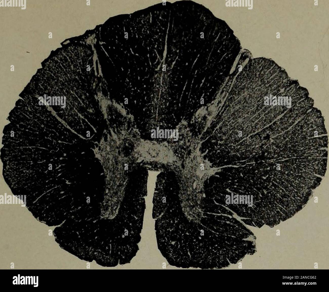 Pyramidal tracts hi-res stock photography and images - Alamy