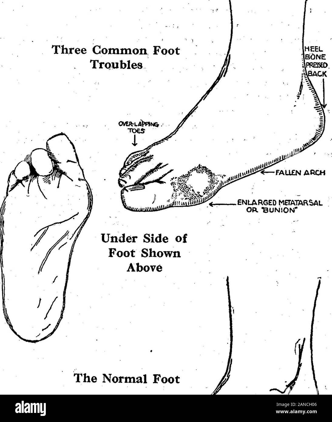 Army Foot Measuring And Shoe Fitting System Prefaced By A Discussion Of ...