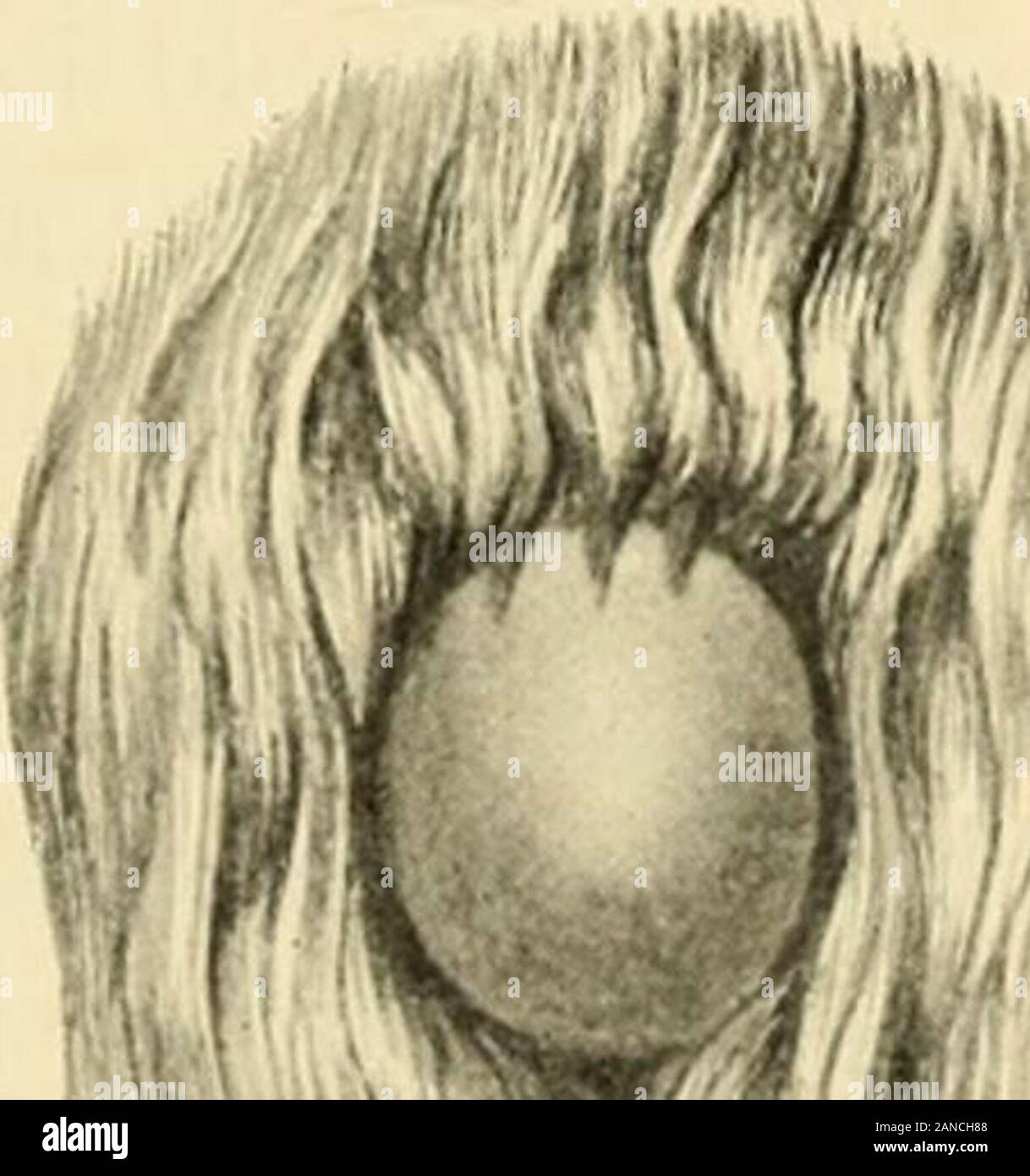 Ergot horse hi-res stock photography and images - Alamy