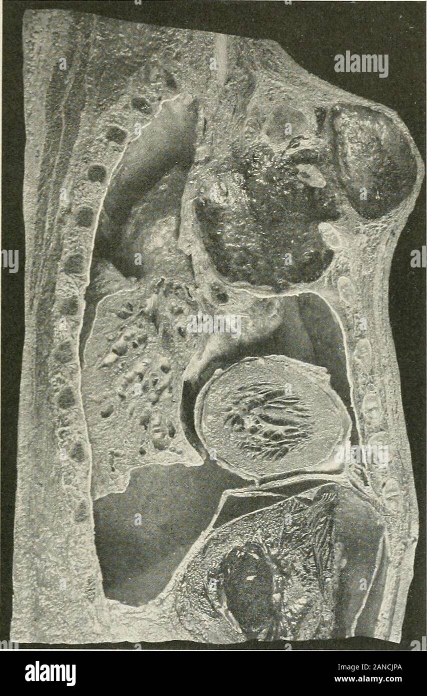 Bulging chest hi-res stock photography and images - Alamy