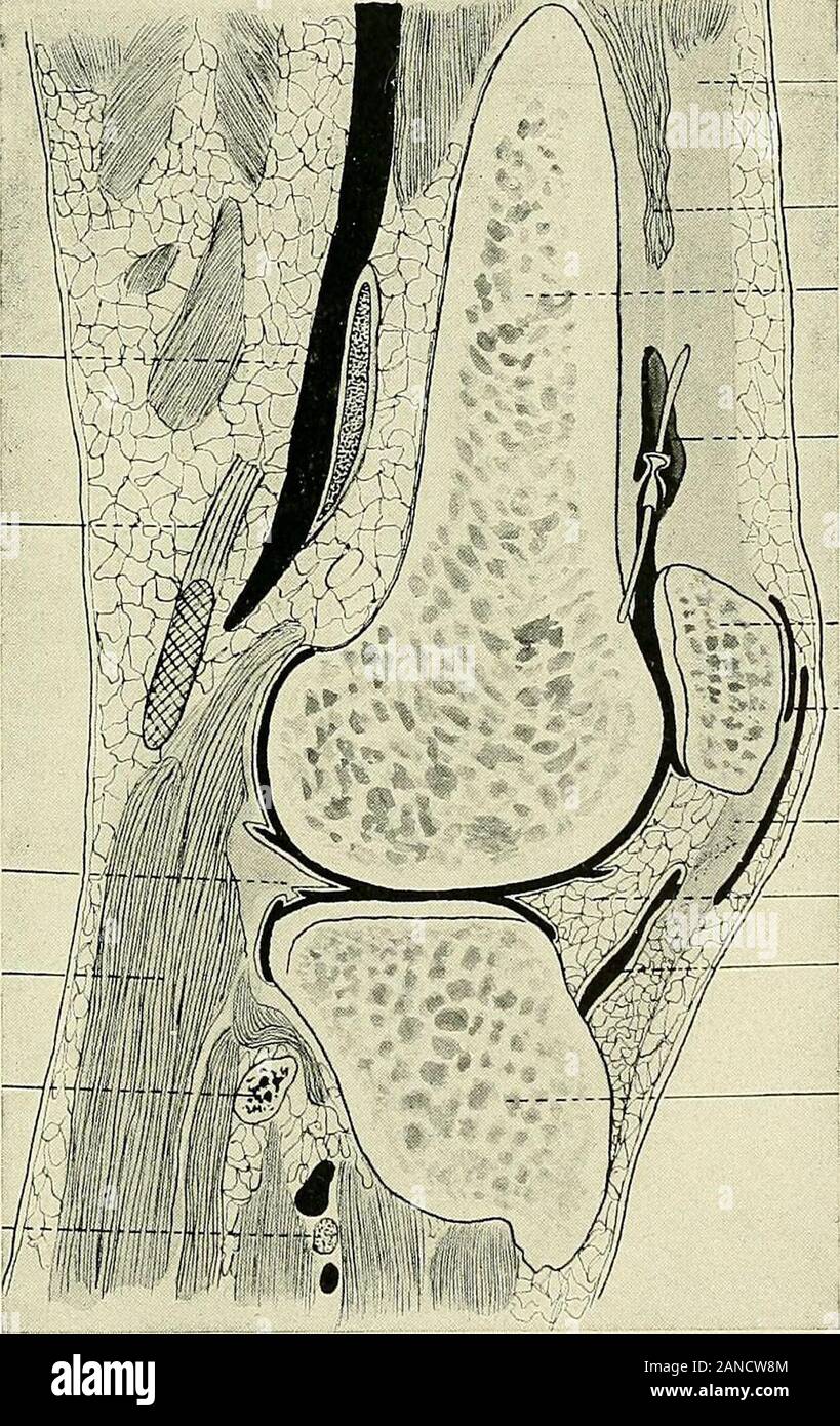 Epiphyseal cartilage hi-res stock photography and images - Alamy