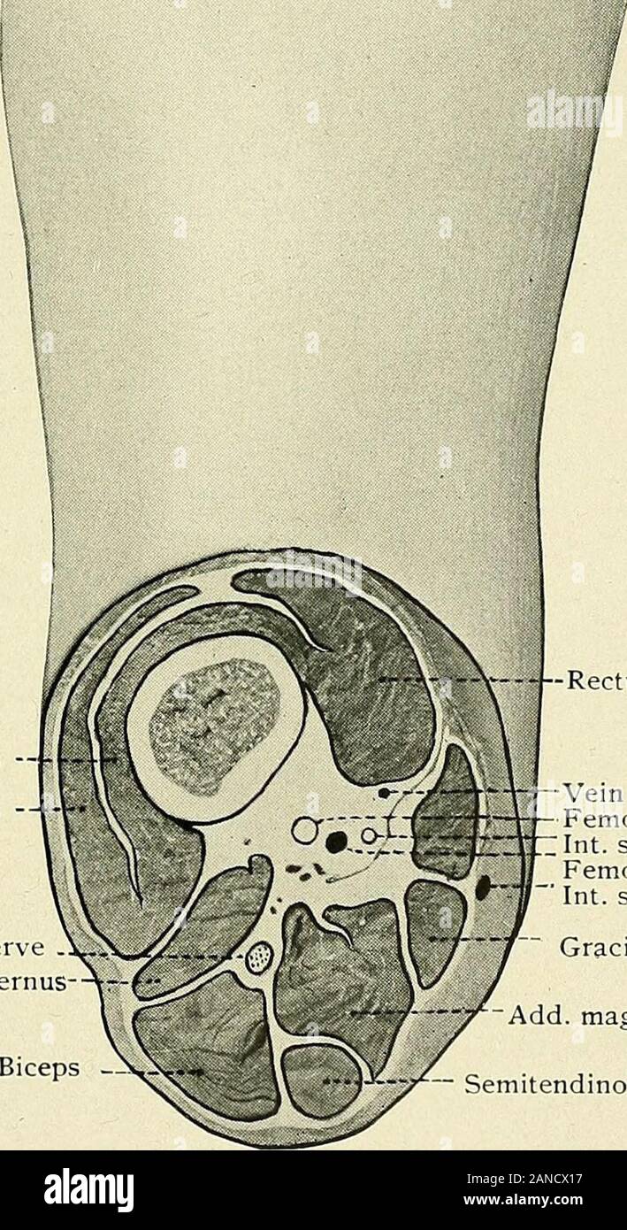 Ileopsoas hi-res stock photography and images - Alamy