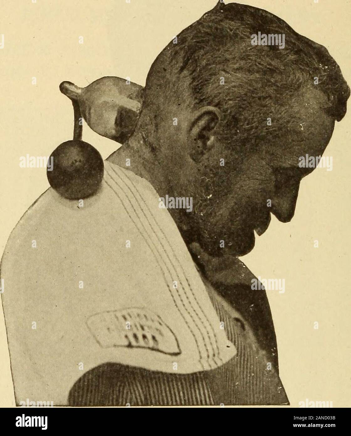 A text-book of practical therapeutics . Fig. 70.—Suction apparatus for ...