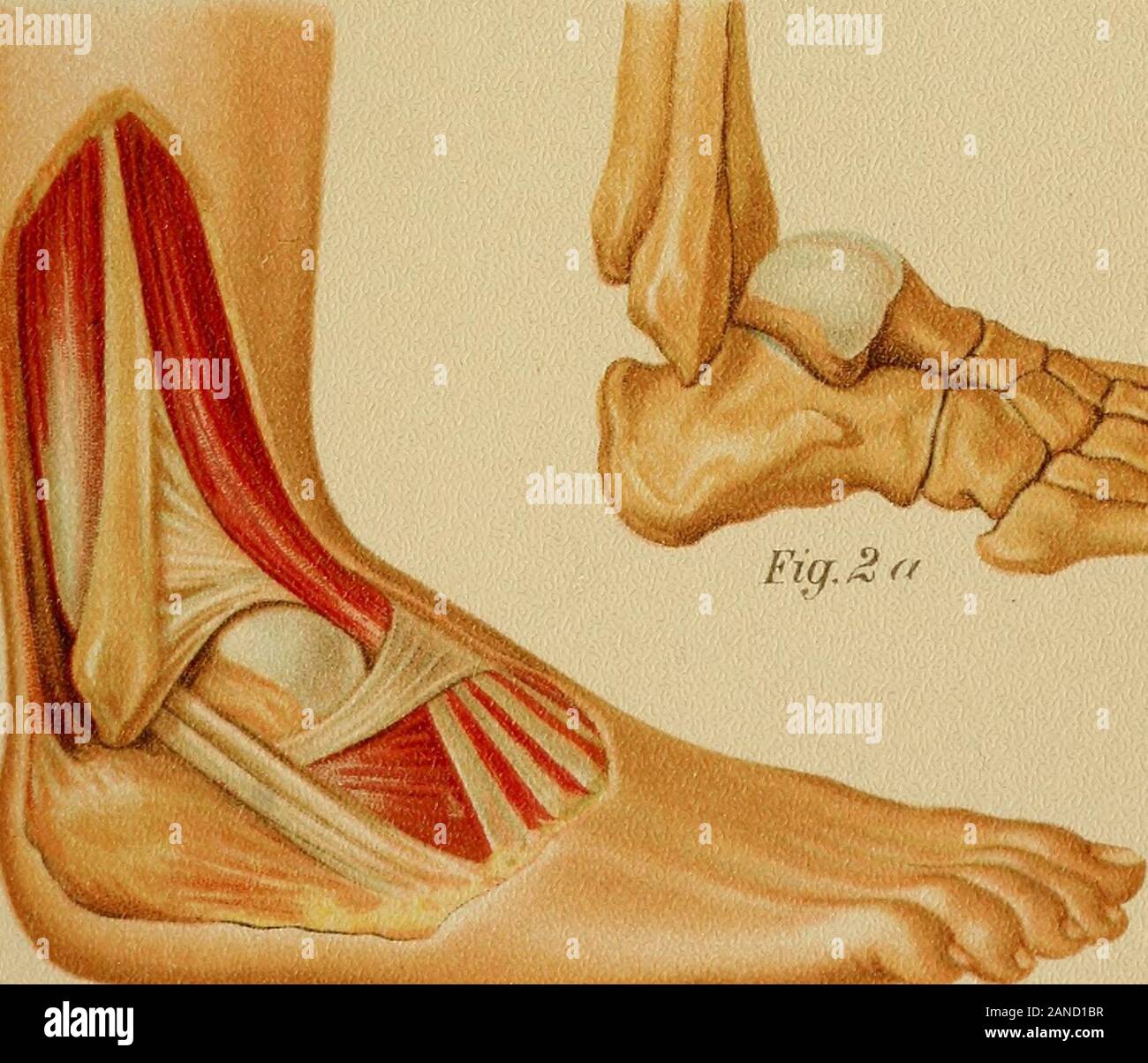 Atlas and epitome of traumatic fractures and dislocations . Fuf.l. LUh ...