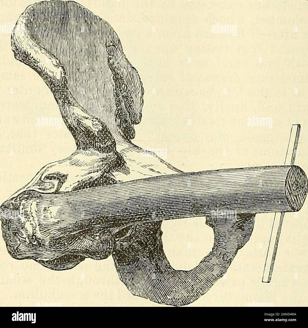 Circumduction Figure