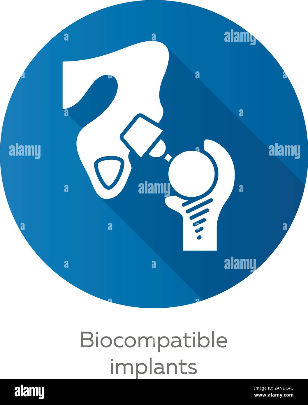 Hip implant medical illustration Stock Vector Images - Alamy