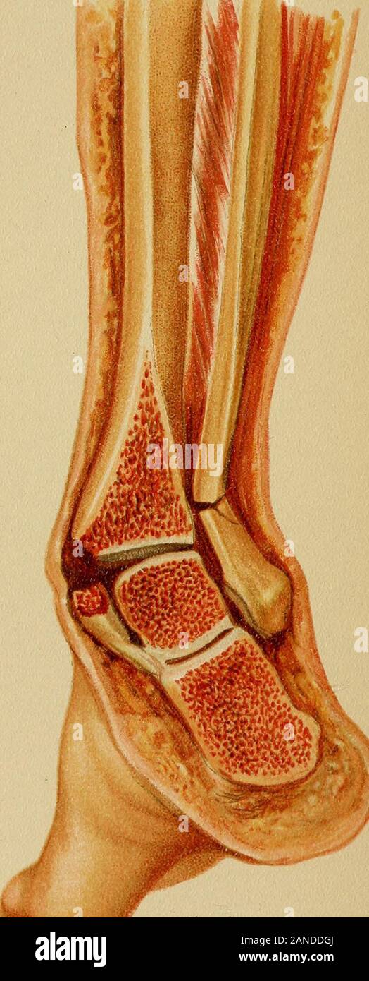 Deltoid ligament of ankle hi-res stock photography and images - Alamy