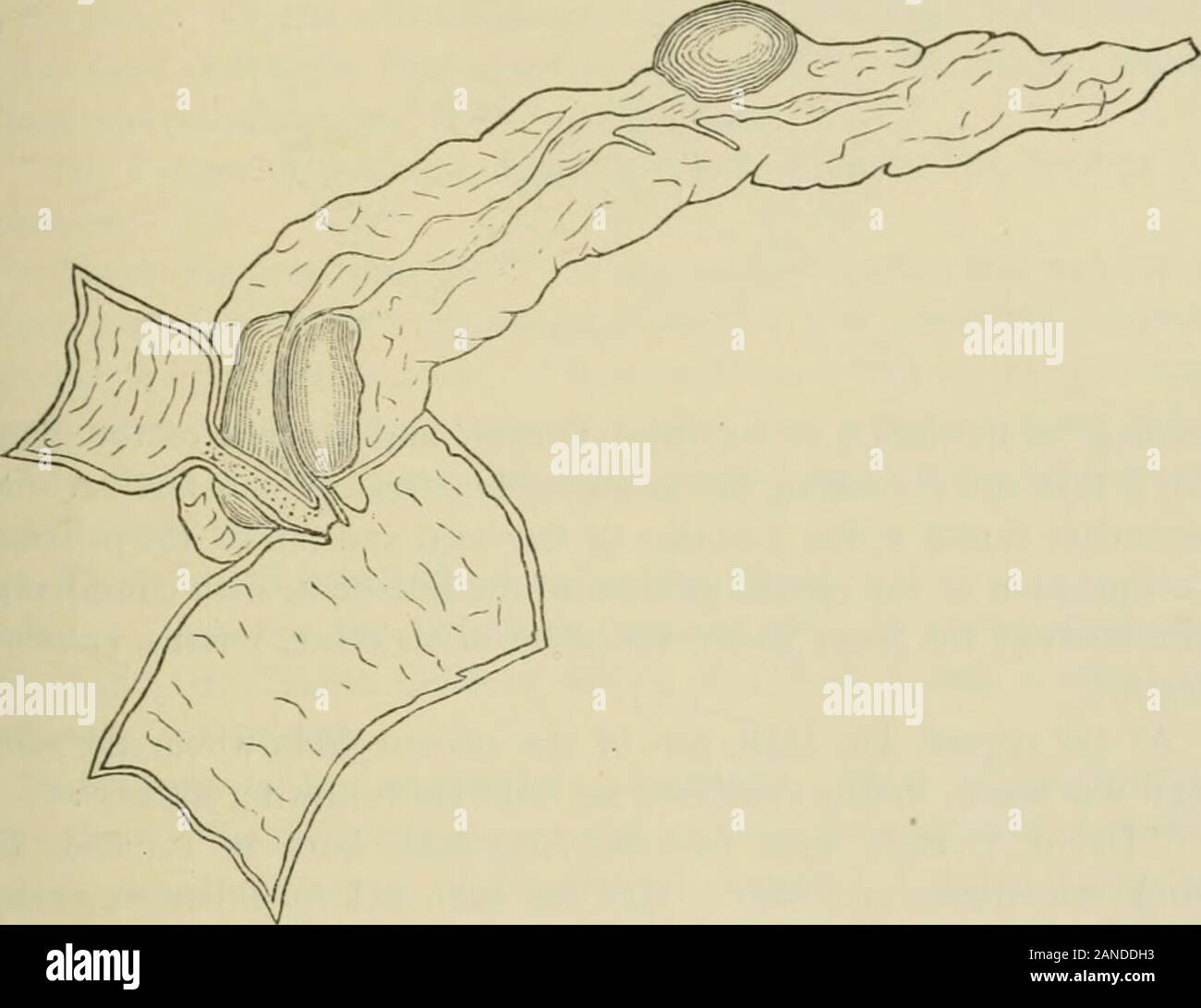 How does the pancreas work hi-res stock photography and images - Alamy