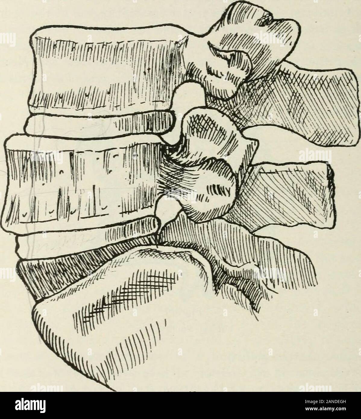 Transverse processes hi-res stock photography and images - Alamy