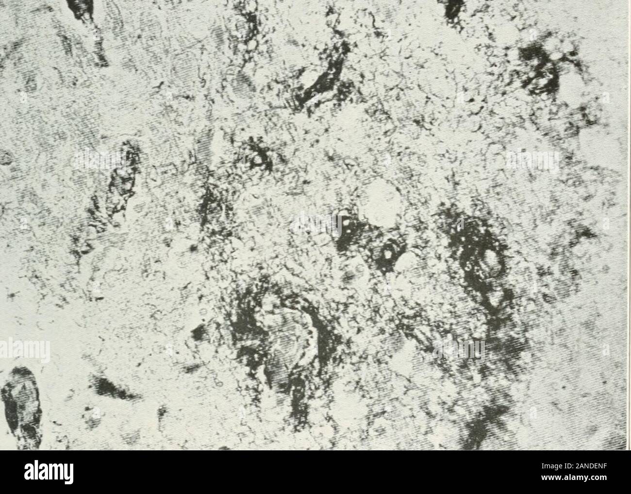 Spirochetes hi-res stock photography and images - Alamy