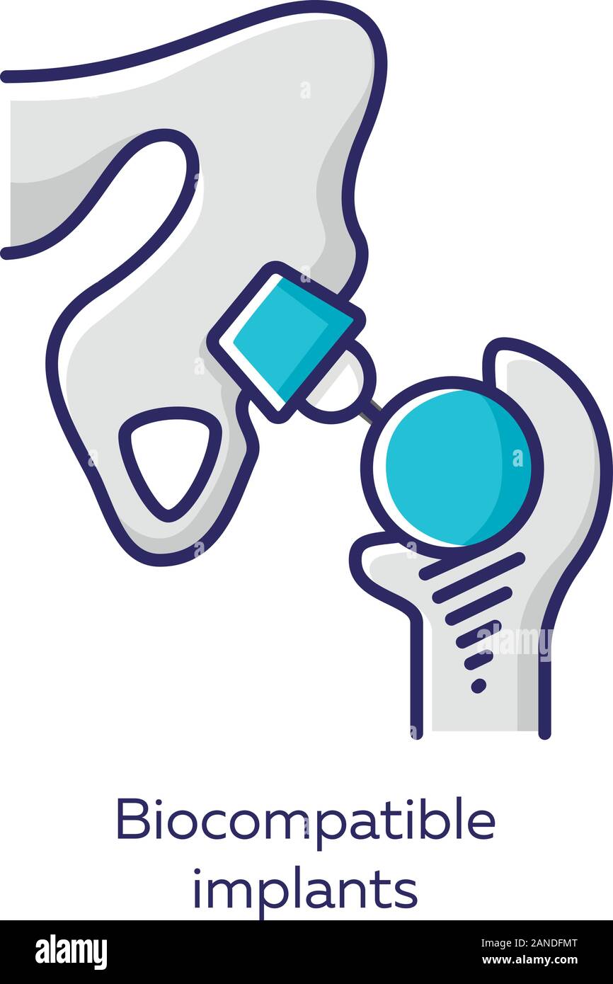 Titanium hip prosthetic Stock Vector Images - Alamy