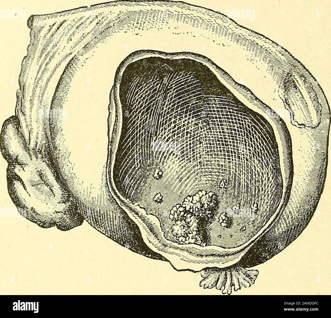 Treatise on gynaecology : medical and surgical . l cavity, but below ...