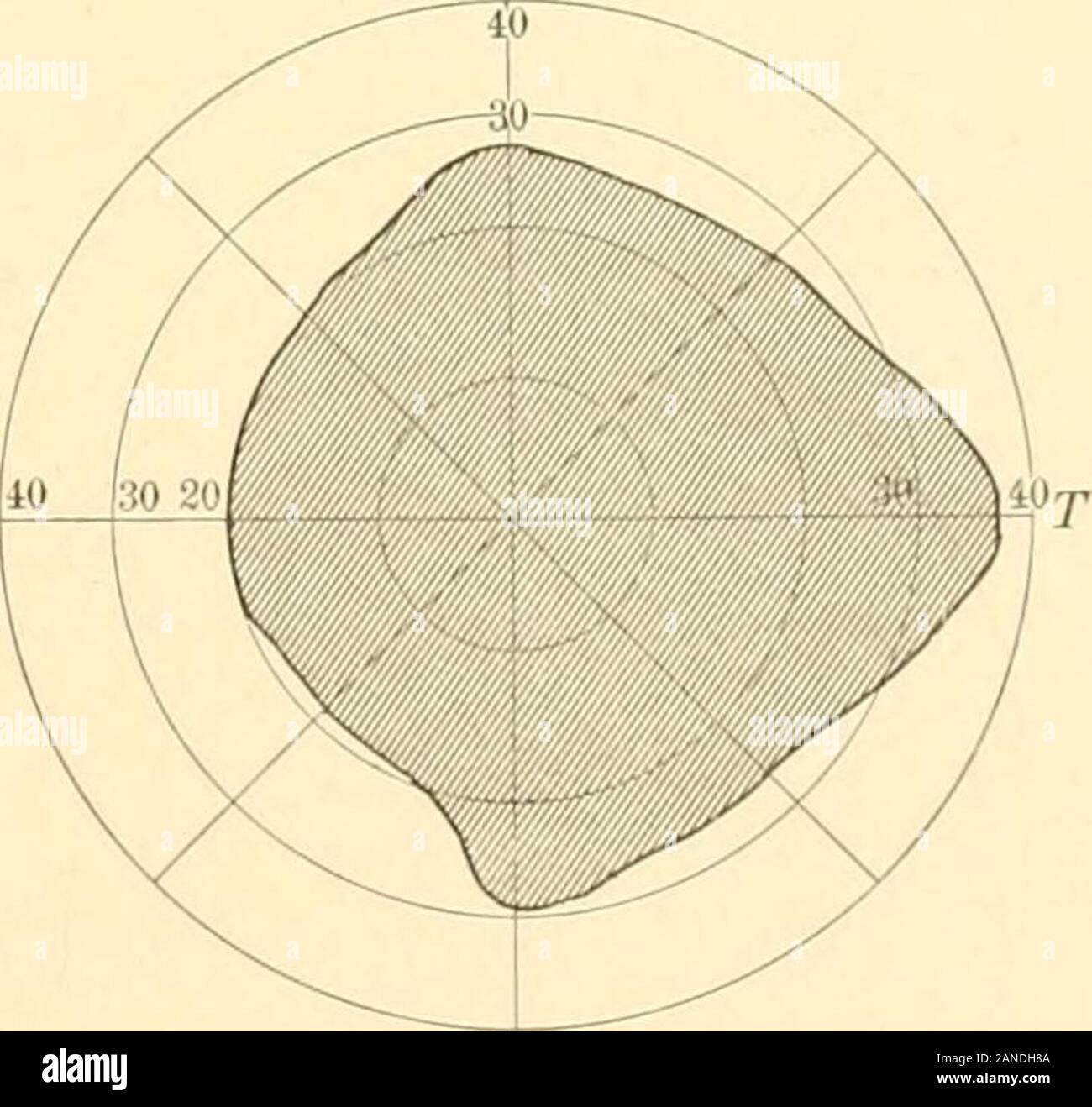 Permanent blindness hi-res stock photography and images - Alamy