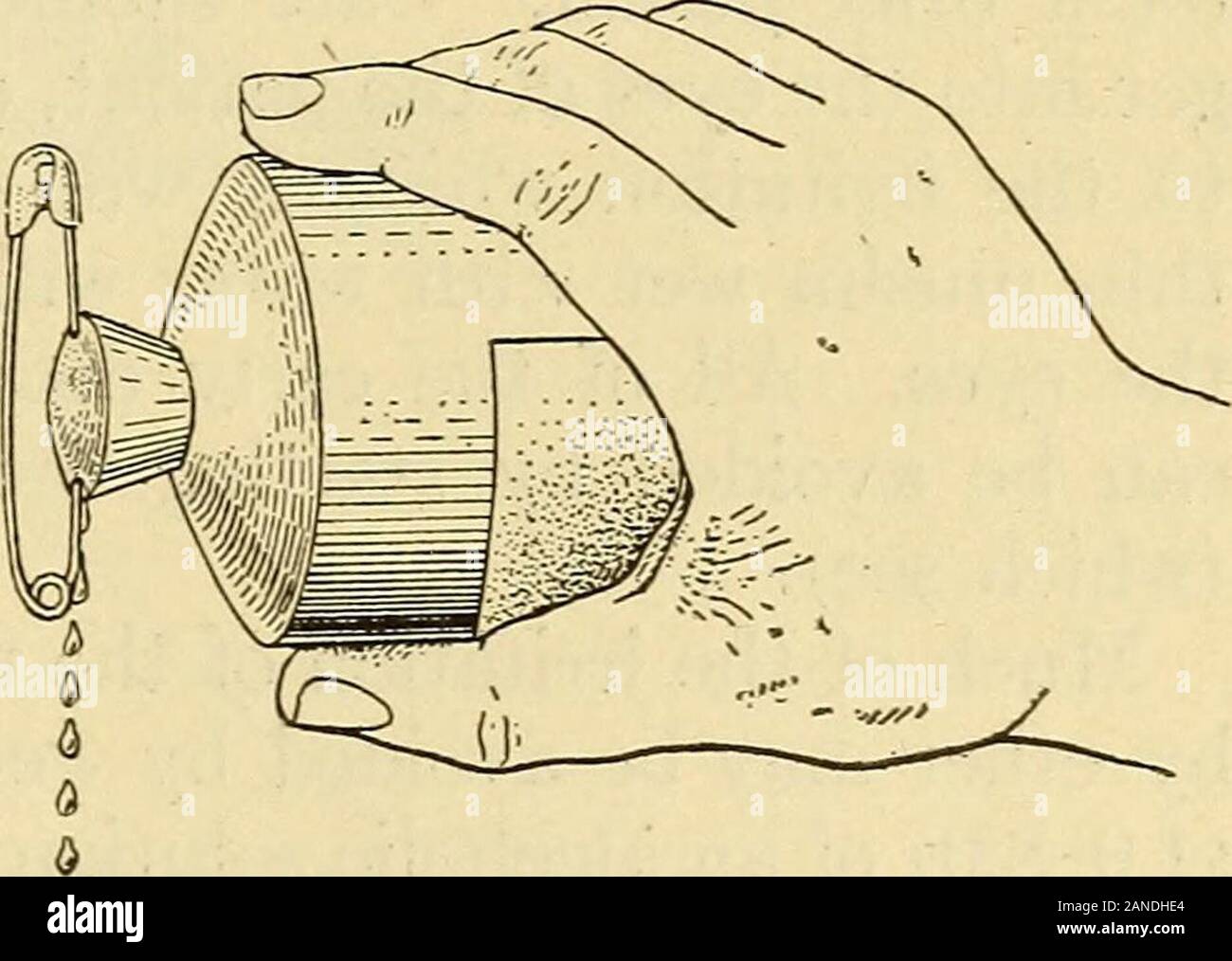 Administration of anesthetic hi-res stock photography and images - Alamy