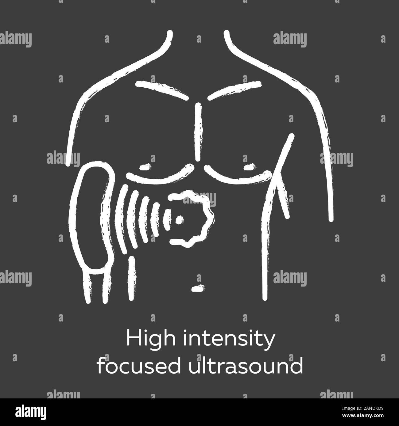 Hifu Stock Vector Images - Alamy