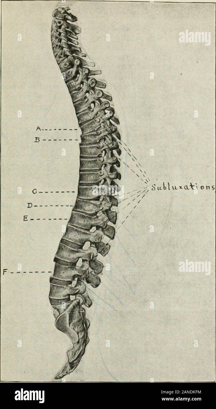 Principles and practice of spinal adjustment; for the use of students ...