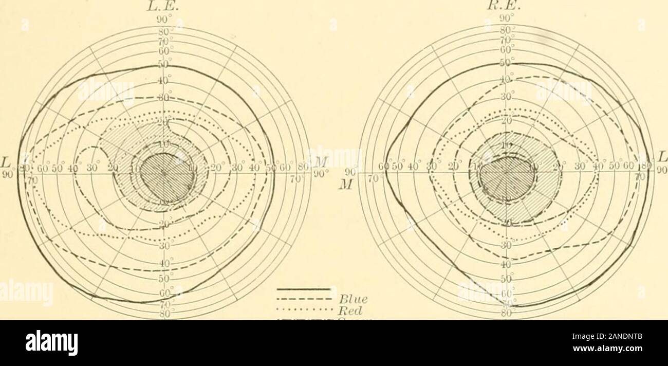 The toxic amblyopias: their classification, history, symptoms ...