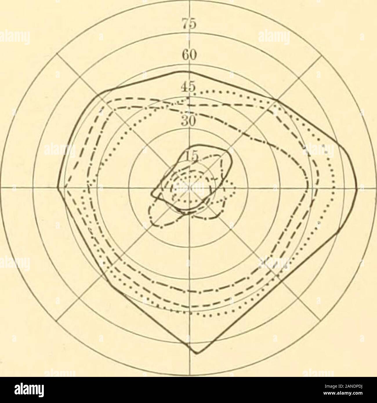 Toxic amblyopia hi-res stock photography and images - Alamy