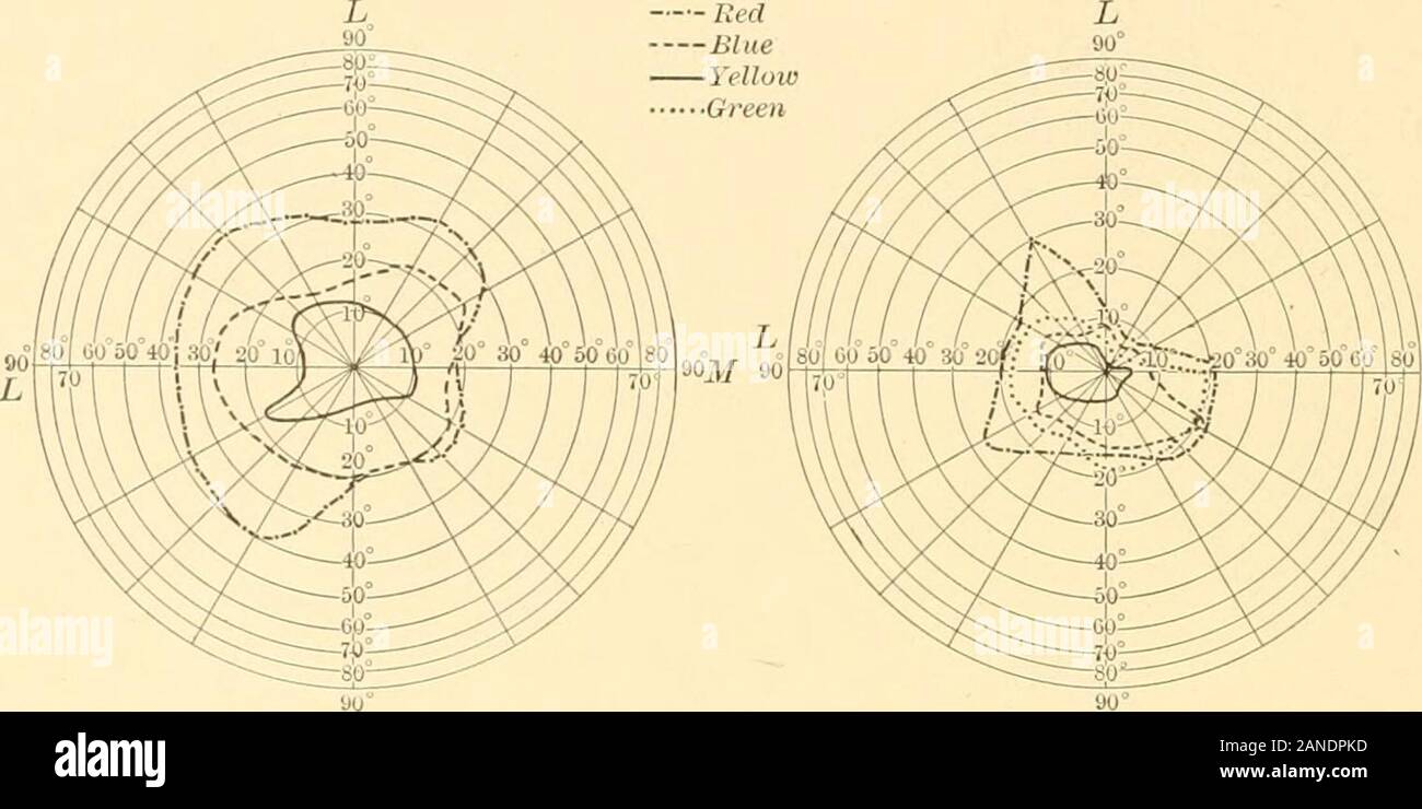 Toxic amblyopia hi-res stock photography and images - Alamy