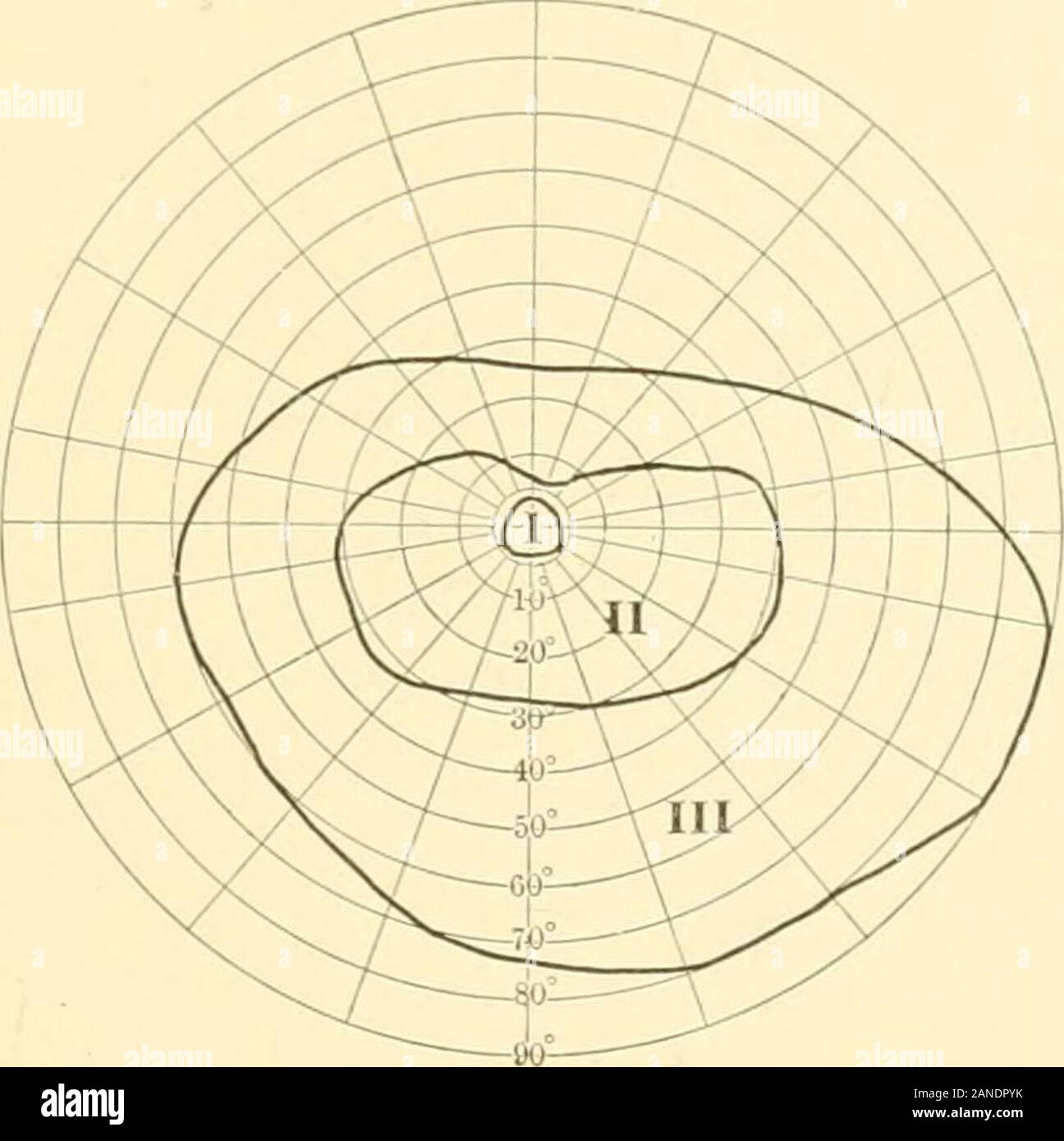 Scotoma hi-res stock photography and images - Alamy