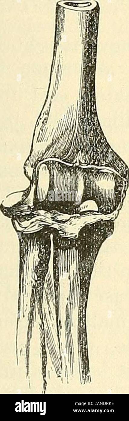 Radial head dislocation hi-res stock photography and images - Alamy