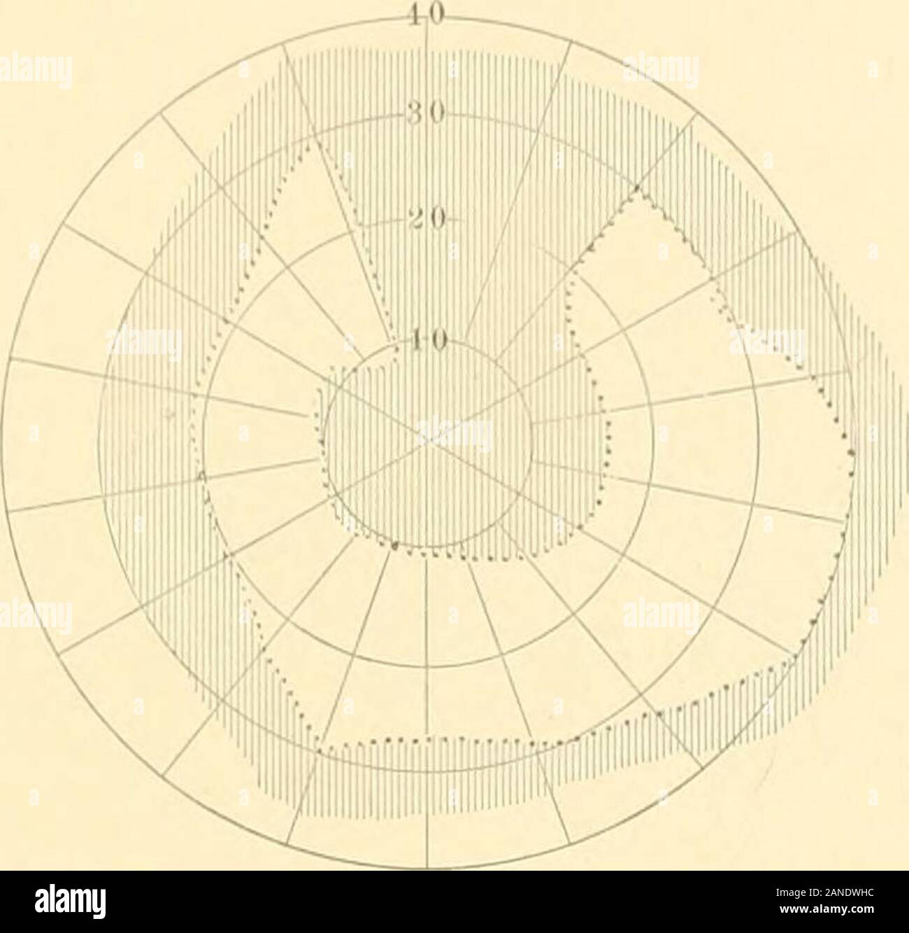 Scotoma hi-res stock photography and images - Alamy