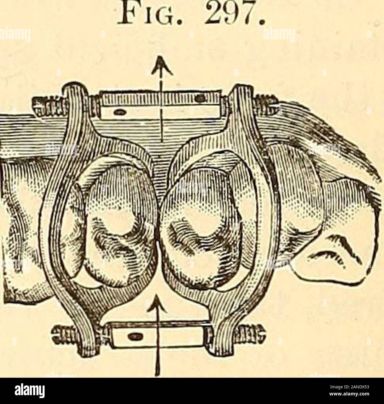 Principles and practice of operative dentistry . Parr separator. Perry ...