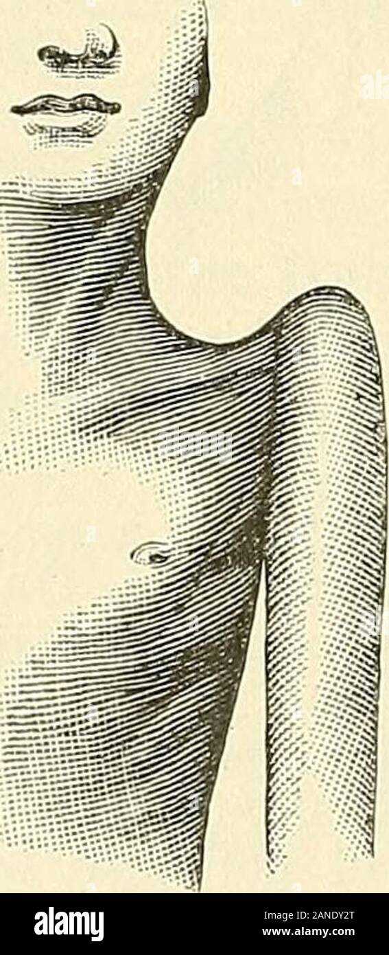 Mammary line hi-res stock photography and images - Alamy