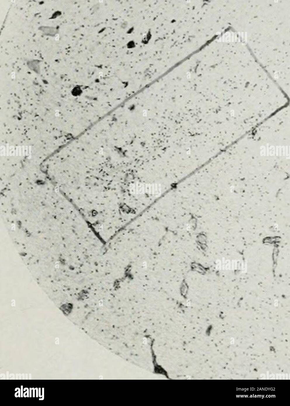 Spinal areas hi-res stock photography and images - Alamy