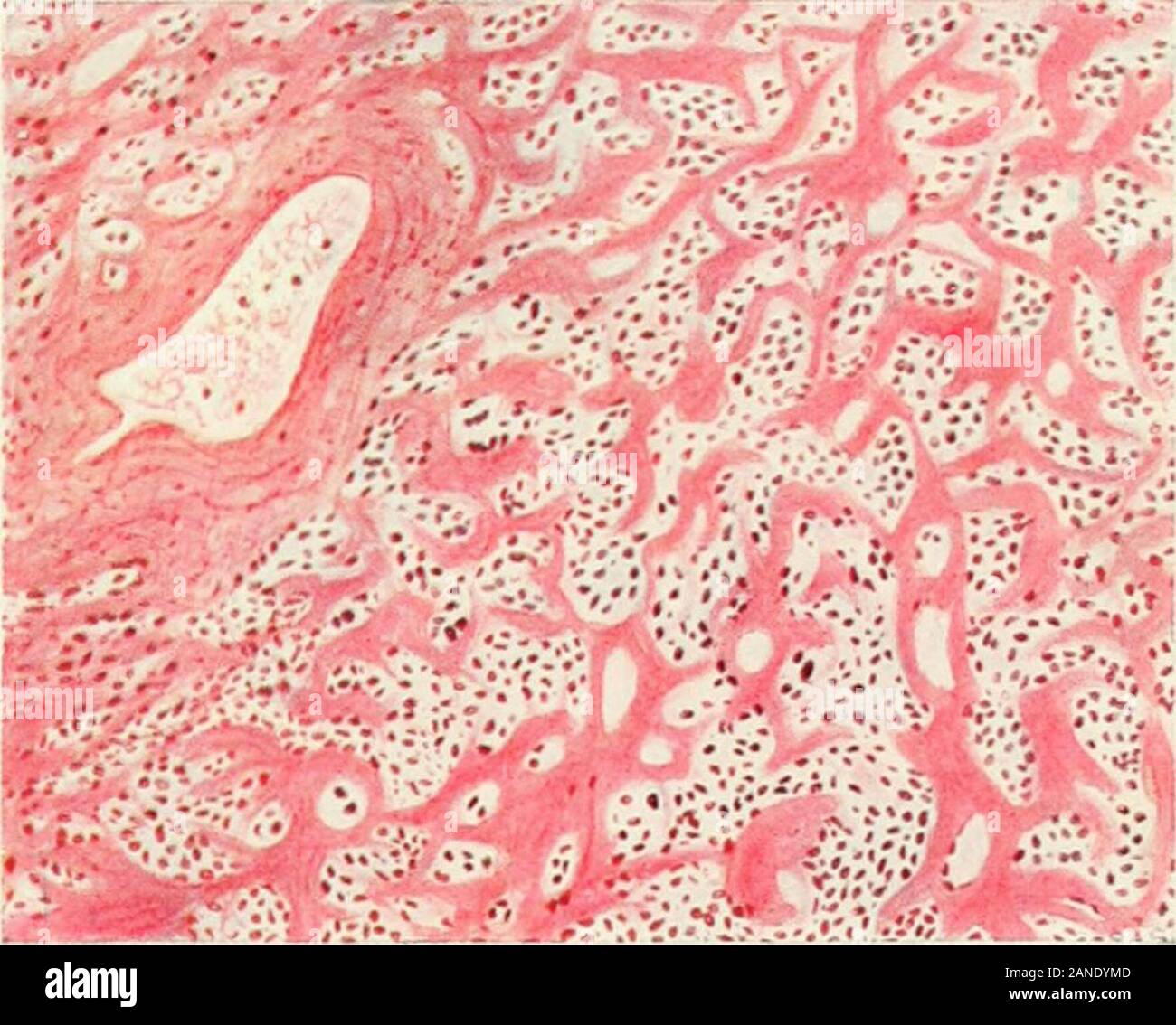 Fibroids and allied tumours (myoma and adenomyoma) : their pathology ...
